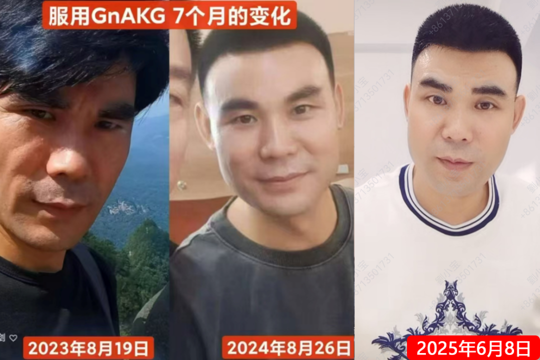 【海购GnAKG】买GnAKG别踩坑！3招避开假产品- 大数跨境