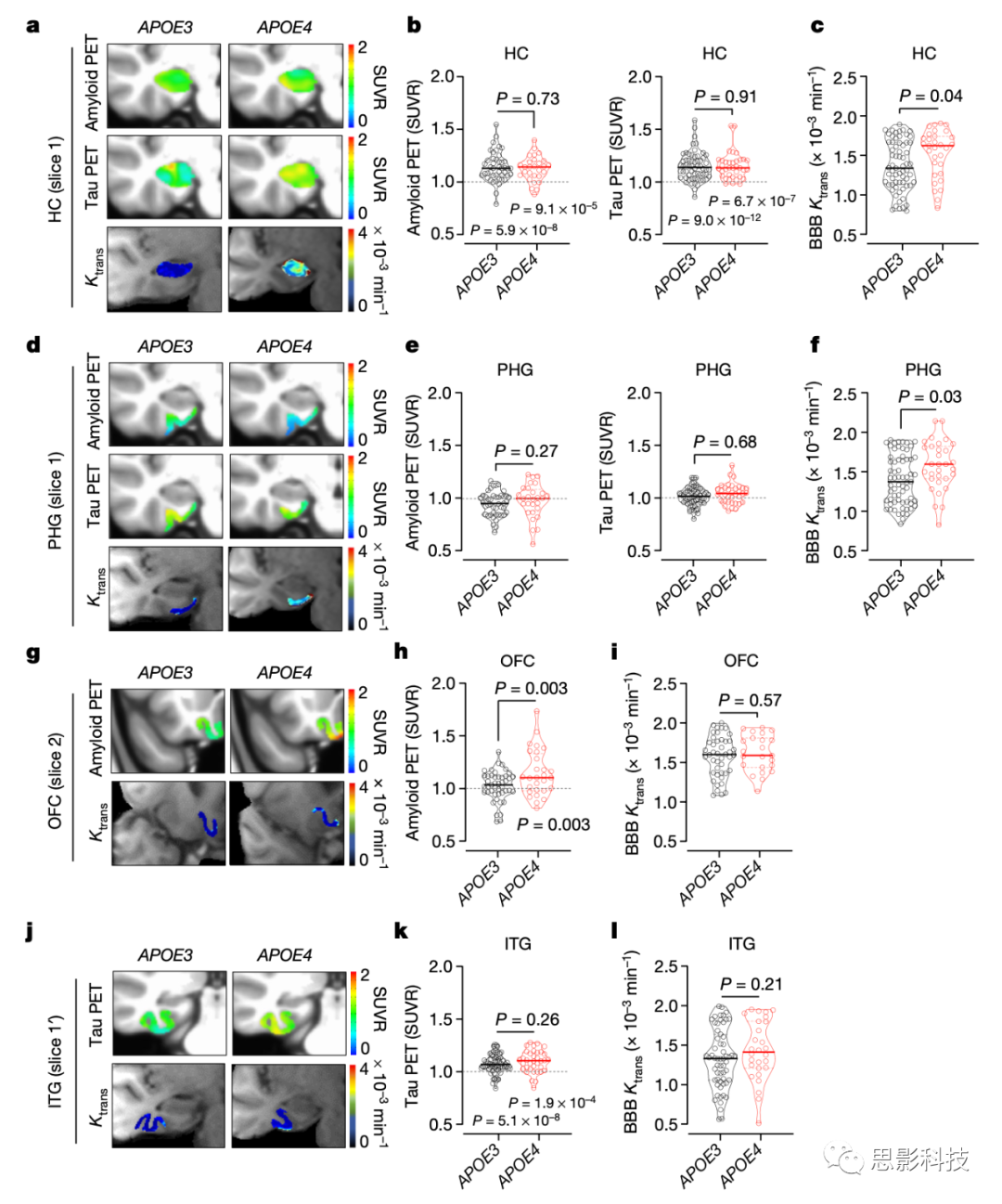 Nature：APOE4诱发血脑屏障功能障碍可预测认知功能下降- 大数跨境