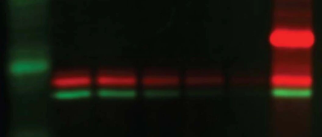 ImageJ | Western Blot 条带定量分析正确方法- 大数跨境